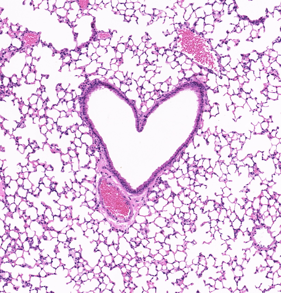 HE染色 - 百仟度生物|病理实验|组化荧光|石蜡切片|透射电镜