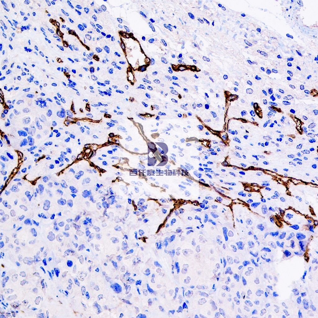 免疫组化 - 百仟度生物|病理实验|组化荧光|石蜡切片|透射电镜
